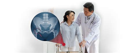 Fracture Liaison Services Programme Elderly Fall Prevention