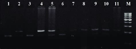 Gh Genotyping After Digestion With Alui Restriction Enzyme M Dna