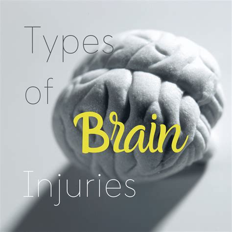 Types Of Brain Injuries Premier Neurology Wellness Center