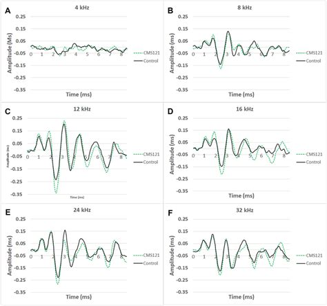 Abr Waveforms At 80 Db Averaged Across Untreated Samp8 Mice Black