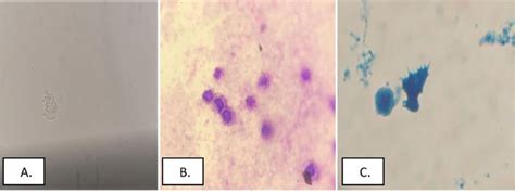 A Trophozoite Of Acanthamoeba In Wet Mount From Culture B Geimsa