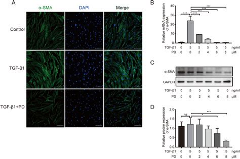 Pd Suppresses Hsfs Activation In Vitro A Immunofluorescence Staining