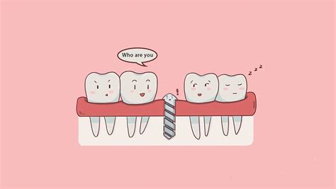 Dental Implant Process Foshan Senda Medical Instrument Co Ltd