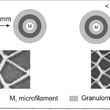 Shrinkage Properties Of Different Meshes Prolene Shrinks 75 94 PTFE Download Scientific