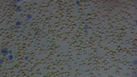 A Trypan Blue Live Rbcs Dead Cells Blue B Trypan Blue 200 X