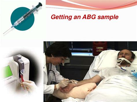 Ppt Arterial Blood Gas Analysis Powerpoint Presentation Free