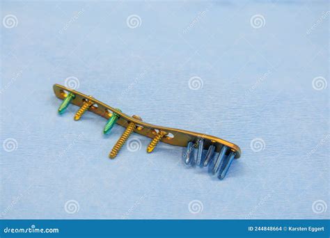 Titanium Surgical Plate And Titanium Screws For The Treatment Of A