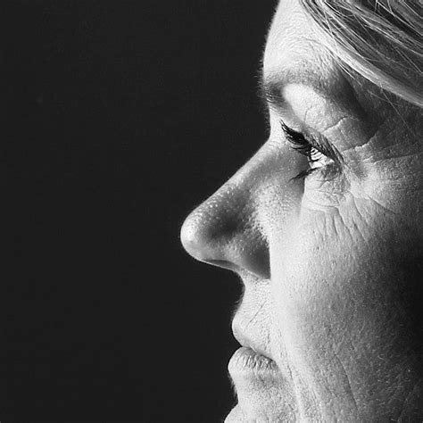 Open Angle Glaucoma Laservision