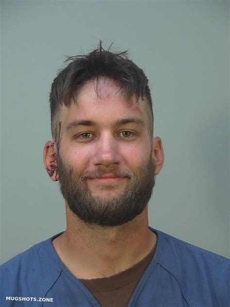 Kinney Dallas Patrick 09042022 Dane County Mugshots Zone