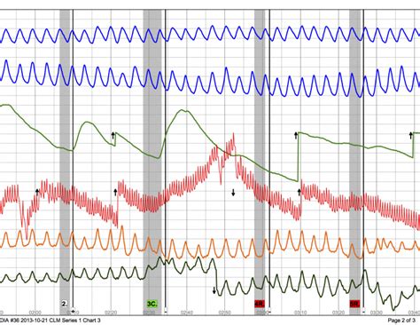 Leaked Documents Point To Dias Inability To Detect Sophisticated Polygraph Countermeasures