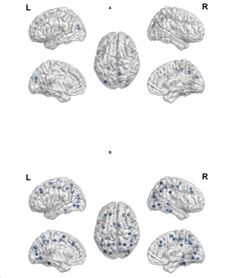 Anatomical Regions With Higher Local Efficiency And Clustering