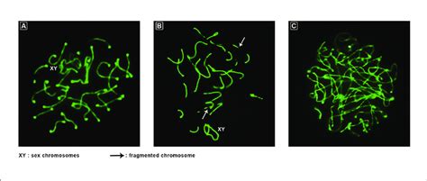 Synaptonemal Complex Abnormalities Observed With The Two Fungicides Download Scientific Diagram