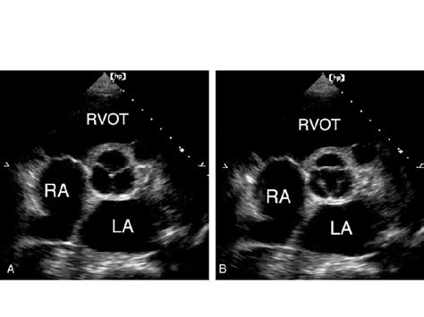 ECHO BASICS II D ECHO AND M