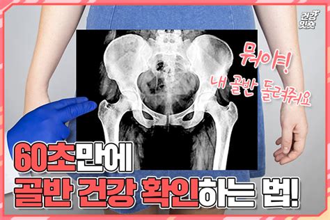 후방 골반 해부학