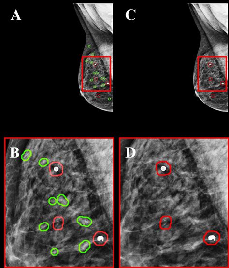 Classification Of Possible Mcs As Normal Tissue Or True Mcs A Most Download Scientific