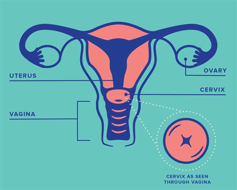 Intracervical Insemination Ici And Intravaginal Insemination Ivi Exp