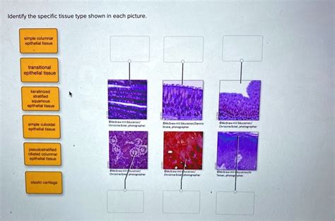 Solved Simple Columnar Epithelial Tissue Transitional Epithelial