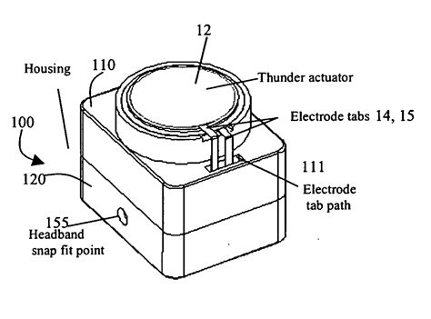 Bone Conduction Hearing Aid Patented Technology Retrieval Search Results Eureka Patsnap
