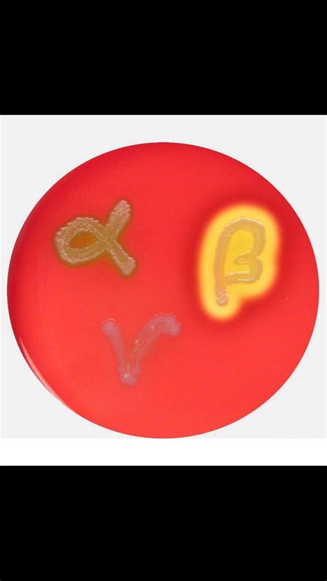 Aida Fakhar On Linkedin Hemolysis Of Streptococci