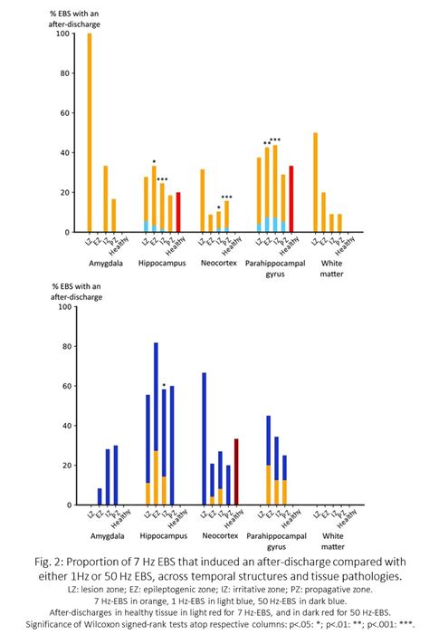 Incorporating New Frequencies Of Electrical Brain Stimulations Tailored To Anatomical Location