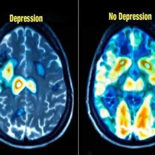 Five Rhythms Of Normal And Depression EEG Signals For Both Hemispheres Download Scientific Diagram