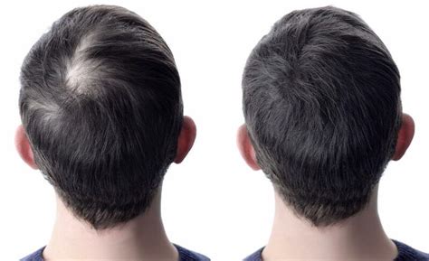 Full Density Scalpmasters