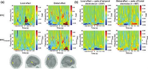 Functional Connectivity A Time Frequency Representations Of