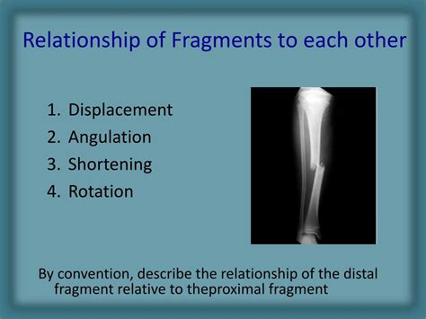 Ppt Radiology Of Fracture Principles Powerpoint Presentation Free