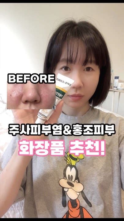 주사피부염 지루성피부염 만성염증 홍조완화 화장품 루틴 추천 염증 피부 화장하기 Youtube