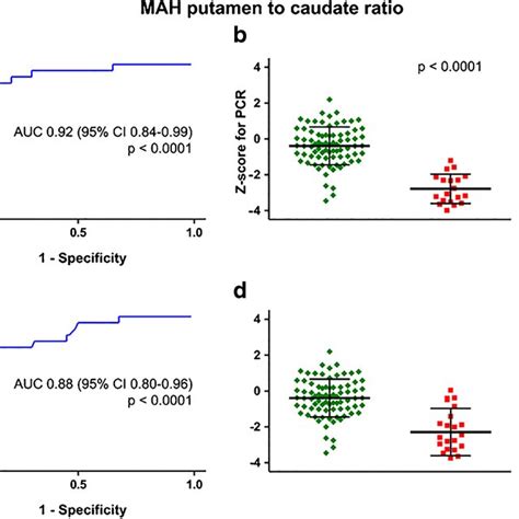 Roc Curve Showing The Diagnostic Accuracy Of Z Scores Of Sbr For The