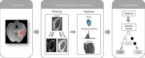 The Radiomics Workflow Comprised Three Steps Segmentation Of The Tumor