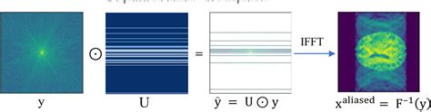 Figure 1 From De Aliasing And Accelerated Sparse Magnetic Resonance