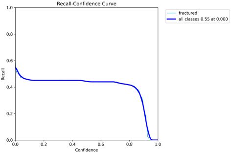 Deep Learning Approach For Arm Fracture Detection Based On An Improved