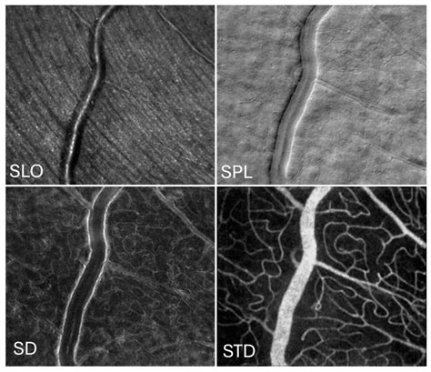 Photonics Free Full Text High Resolution Retinal Imaging Technology Overview And Applications