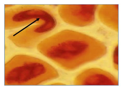 Allium Cepa Root Cells Indicate Genotoxicity Of Tannery Effluent By The Download Scientific