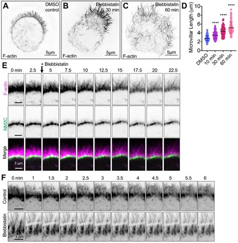 Inhibition Of Nm2 Elongates Microvilli And Limits Actin Turnover Sim