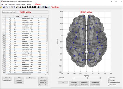 brain atlas braph