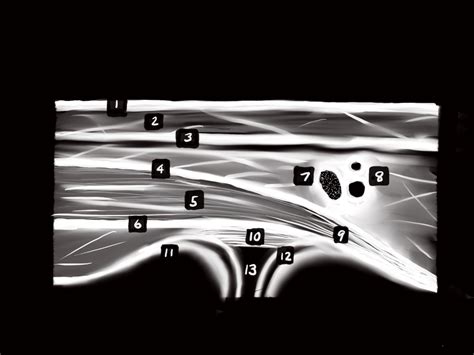 Msk Ultrasound An Ijspt Perspective Published In International Journal Of Sports Physical