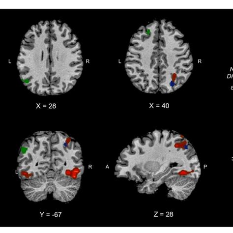 The Neural Rebound Effects For Nonsymbolic Numerical Magnitude Download Scientific Diagram
