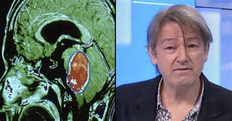 Lucas A Beacon Of Hope Teenager Beats Rare Brain Cancer Dailywize