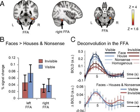 Fusiform Face Area Diagram