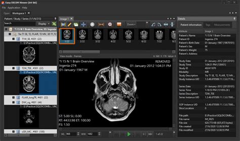 color schemes in easy dicom viewer yohz software development blog