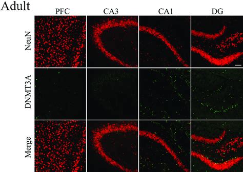 Double Immunostaining Of Dnmt3a And Neun In Adult Mice Sample Images Download Scientific