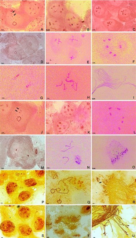 Histological And Cytochemical Staining Results Zaprionus Indianus