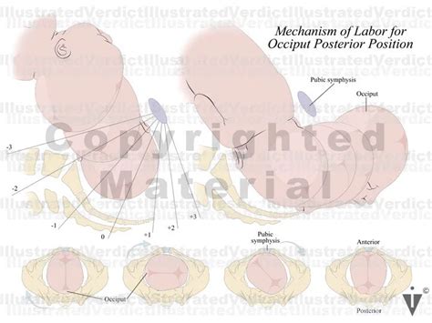 Stock Pregnancy Delivery Normal Delivery — Illustrated Verdict