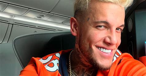 Alex Caniggia Sorprendió Con Un Impactante Retoque Estético “me Lo Tuve Que Sacar” Infobae