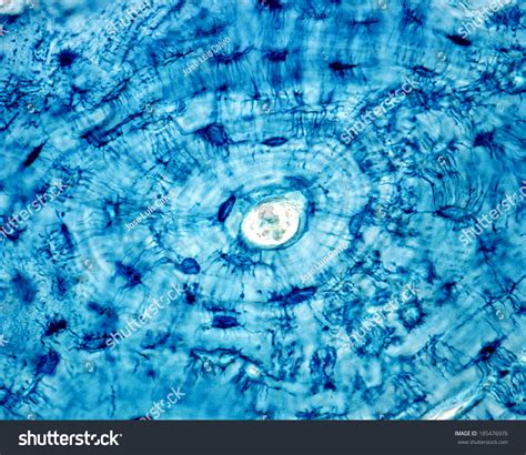 Osteocyte Microscope