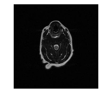 Create Image Datastore Containing DICOM Images MATLAB Simulink
