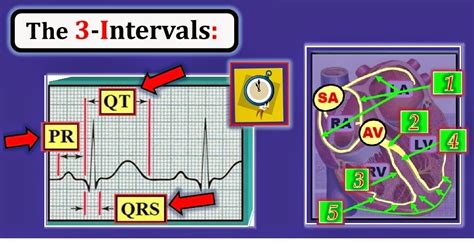 ECG Interpretation ECG Blog 89 Basic Concepts 2 Intervals PR QRS QT