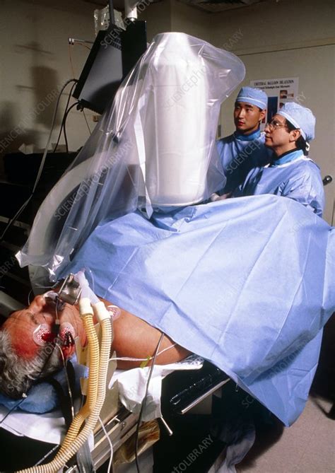 Patient Undergoing Laser Lithotripsy Procedure Stock Image M700